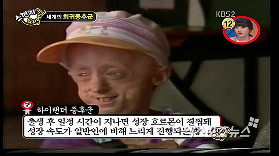 하이랜더 증후군 평생 늙지 않아 실제로 가능