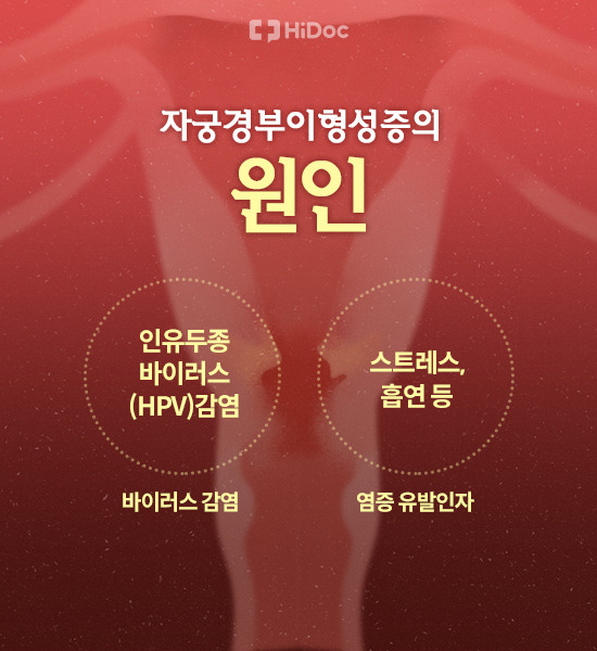 자궁경부암 전 단계 자궁경부이형성증 증상은