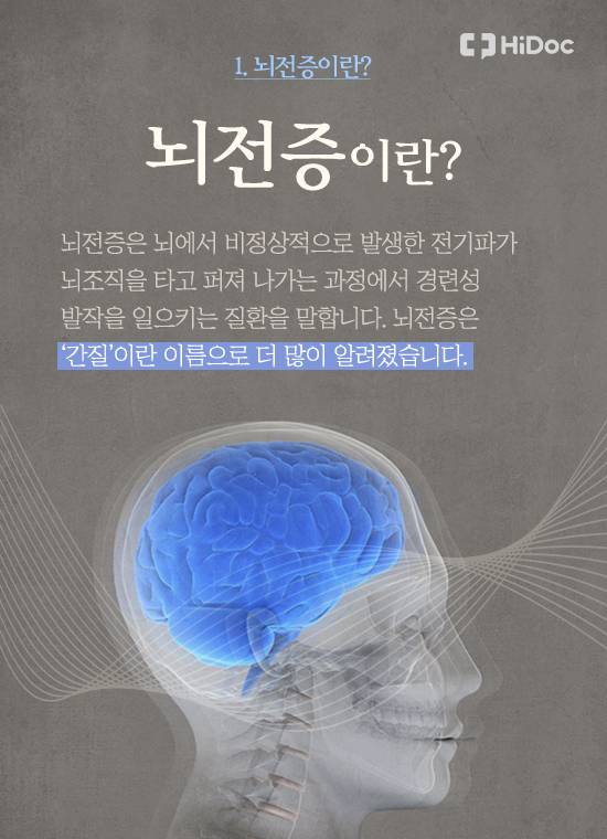 간질 발작 일으키는 뇌전증 증상과 치료