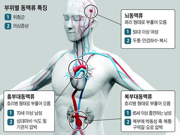 뇌동맥류는 두통·복시 복부는 박동성 혹 만져지면 의심