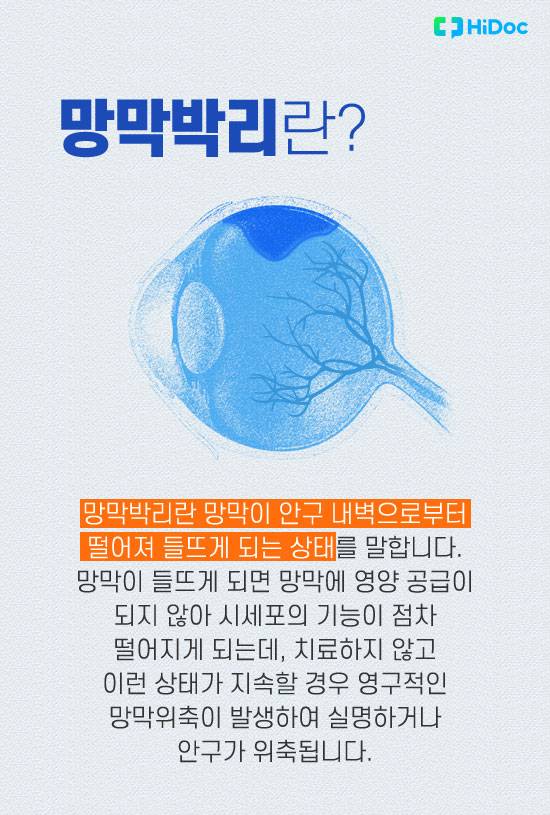 근시가 심하면 생길까 망막박리 생기기 쉬운 경우 4가지