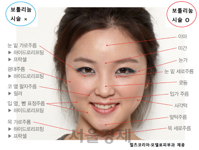 수술 없이 주름 쫙 사각턱 갸름 보툴리눔 시술이 해결사