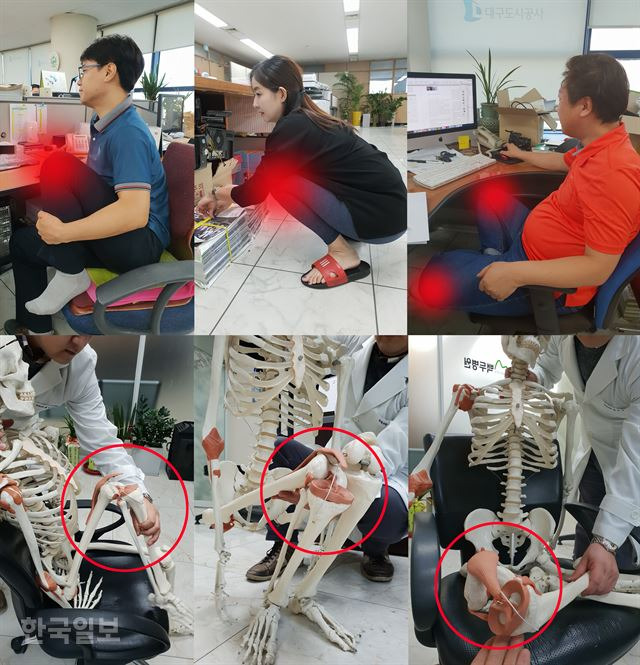 20대도 주목 인공관절 수술 부르는 나쁜 자세 3가지