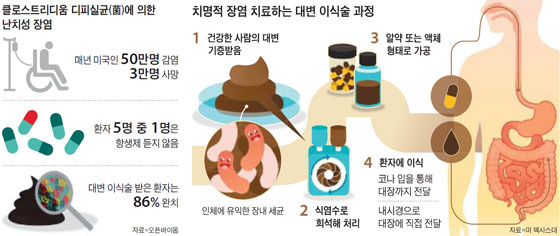 환자와 제약사 간의 장내 세균 치료제 전쟁