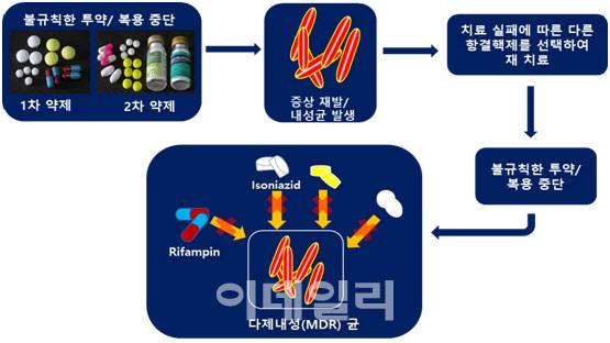 인류와 함께 진화해온 결핵 백신없어 위험천만한 결핵