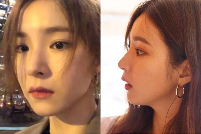 콧대 너무 예뻐 성형외과에서 가장 많이 언급된다는 여배우 키노라이츠