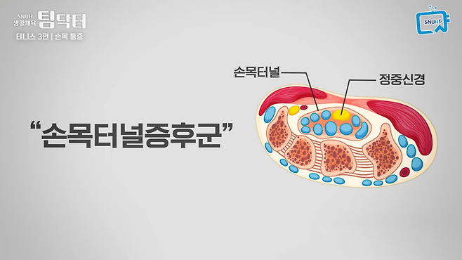 손목 통증엔 온파스와 냉파스 중 어떤 게 좋나요 서울대학교병원