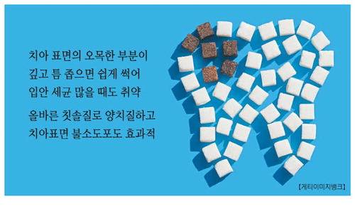 꼬박꼬박 양치질하는데왜 나만 충치가 잘 생길까