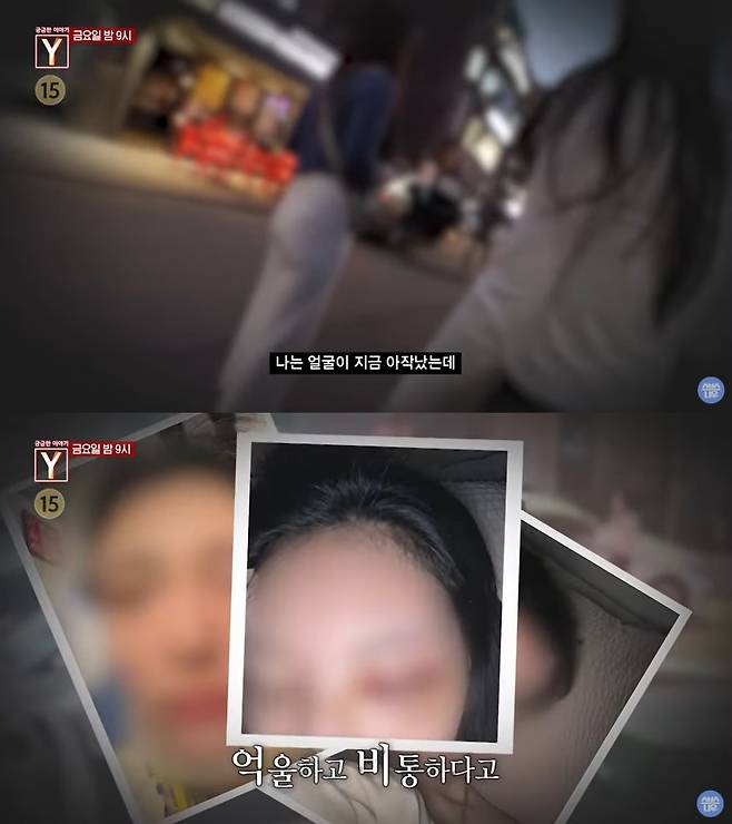 압구정 거리 女얼굴에 풀스윙 펀치배우 지망생 뼈 부서진 채 기절 영상