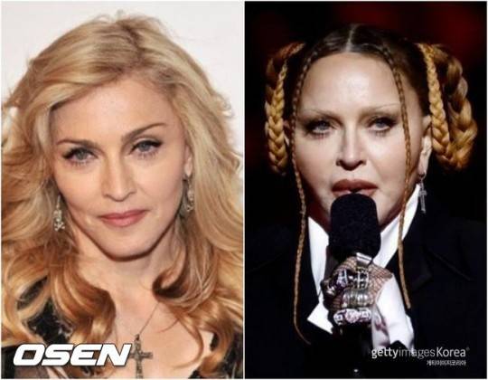 ' Shaped charge side effect' Madonna , Mug shot Restored successfully ...