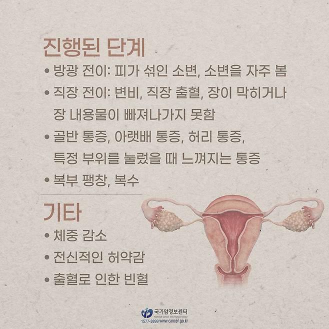 자궁내막암 단계별로 나타나는 증상이 있다 자궁암 국가암정보센터