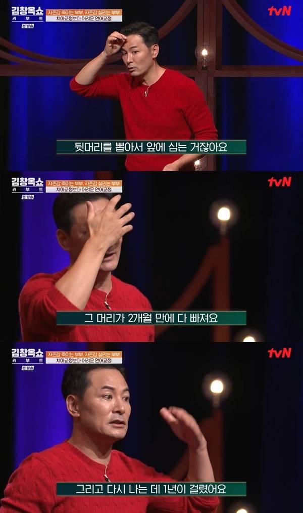 김창옥 모발이식 3번 해 결혼은 선택 모발이식은 필수” 김창옥쇼 결정적장면