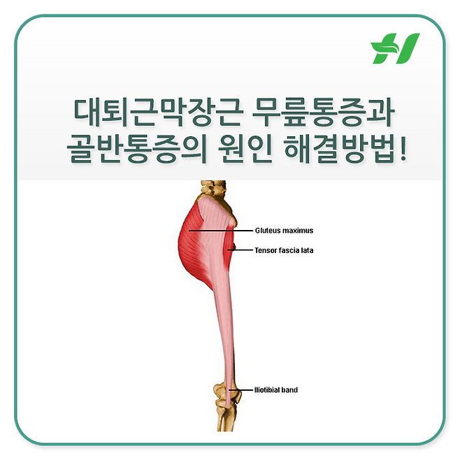대퇴근막장근 무릎통증과 골반통증의 원인 해결방법 리얼리햅