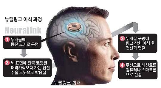 생각한대로 제어 인간 뇌 ‘칩 꽂다