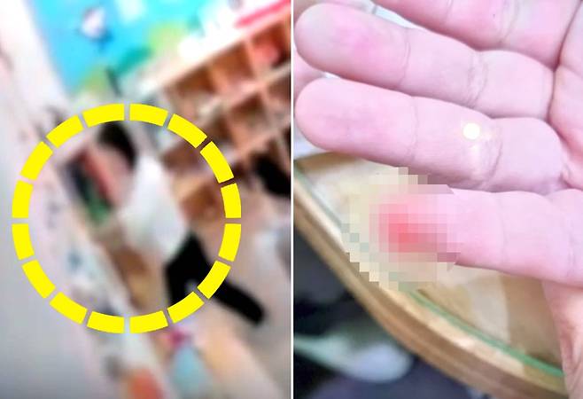 교실 오는데 문 닫아 4살 아이 손가락 절단유치원 교사 檢송치