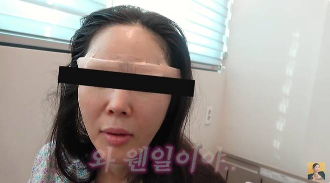 장영란 6번째 눈 성형수술♥한창 재혼한 건가”a급장영란