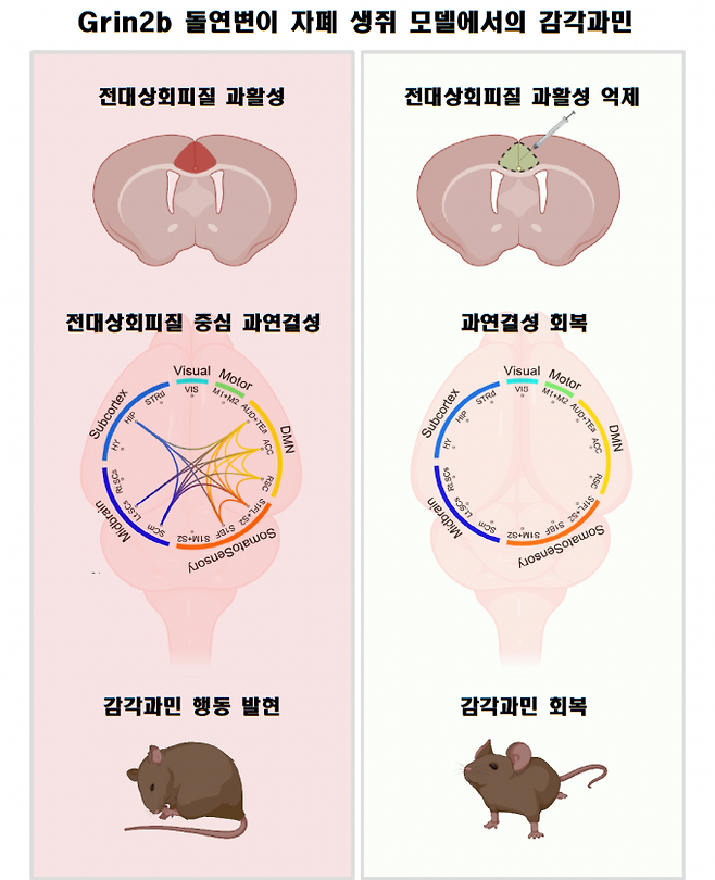 자폐 환자가 작은 자극에도 괴로워하는 이유