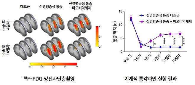 극심한 신경병증성 통증 원인은 별세포 신경전달물질 과분비