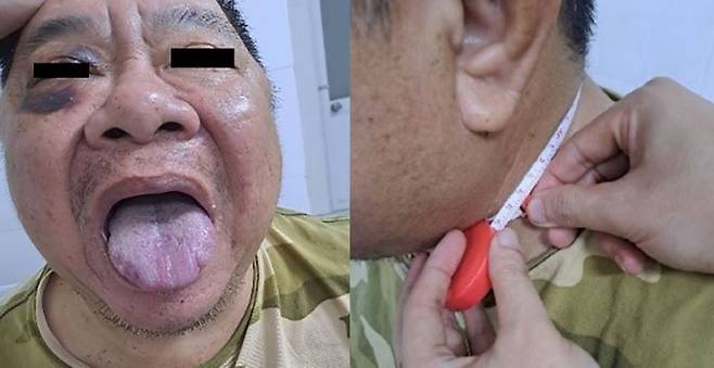 몸 ‘이렇게 변한 탓에 9개월간 교통사고 4번 겪은 남성 어떤 사연일까
