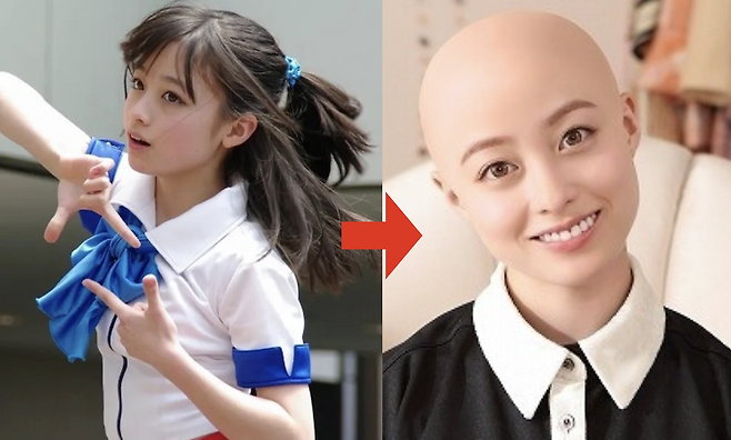천년에 한번 나오는 미모 천년돌의 역변한 충격 근황 스타픽