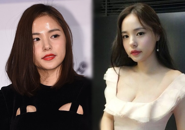 심각한 알레르기 피부인데 백옥 도자기 얼굴 유지하는 여배우 비밀 연예는 내운명
