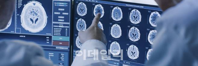 다국적 제약사들 치매신약 투자k바이오 기술수출 가능성은
