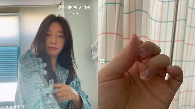 종양이 뼈까지 침범 대학가요제 인기 가수 충격 안타까운 소식 근황 나남뉴스