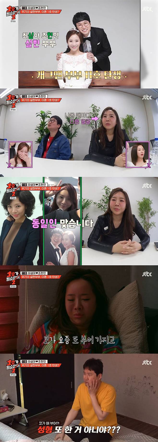 "성형수술 과해" 개그우먼 최설아, 코 3번·지방흡입 2번…부작용 고백